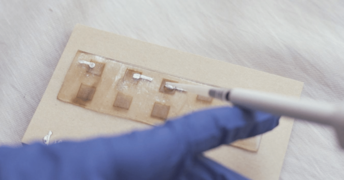 Electric Skin: The Future of Compostable Energy Sources